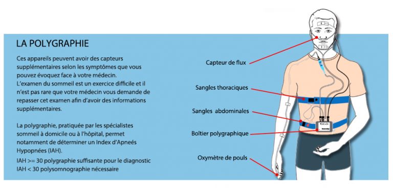 La polygraphie ventilatoire (PG) | InnoMed